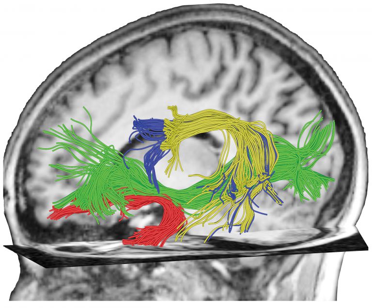 Professor Angela Friederici - The Neurobiology of the Human Language ...