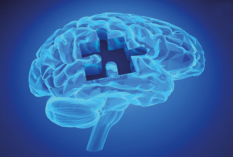 Dr Jun Hua - Innovations in Functional Brain Imaging to Improve ...