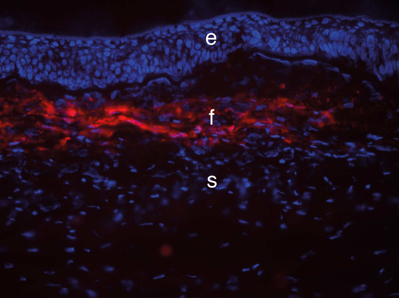 Professor Steven E. Wilson - Clearing the Haze: Understanding the ...